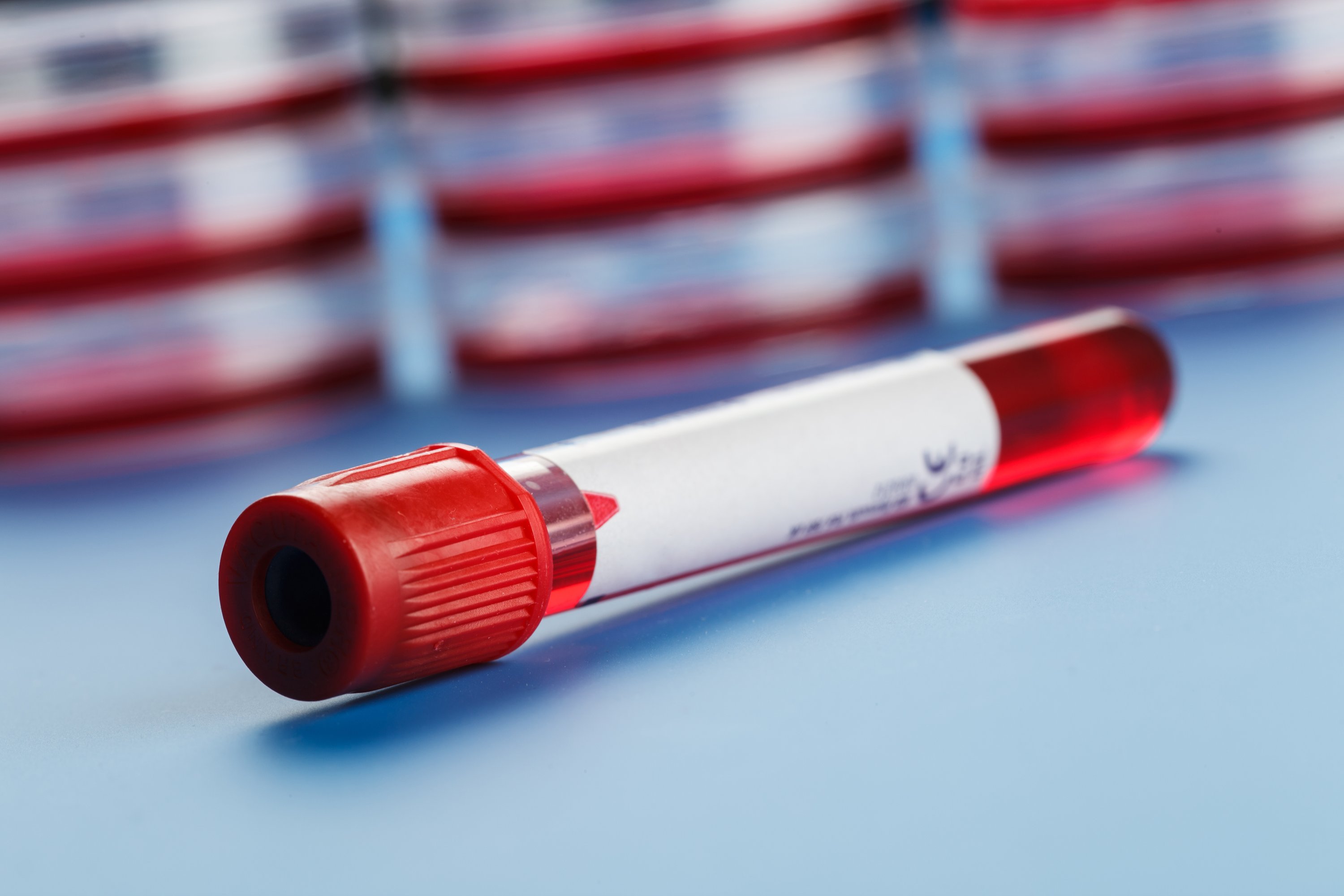 Blood Viscosity Application Note | m-VROC II